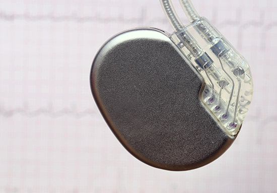 Global Cardiac Rhythm Management Device Market Competition is intense ...